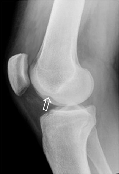 Pelvis y miembro inferior