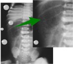 Otros signos de colon